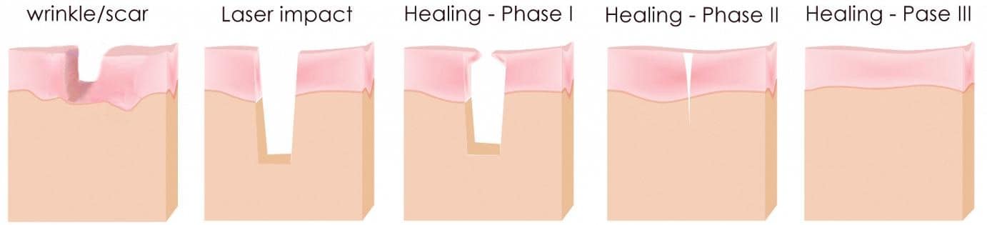 Wrinkle Treatment Options Pasadena, CA - Dr. Nima Plastic Surgery